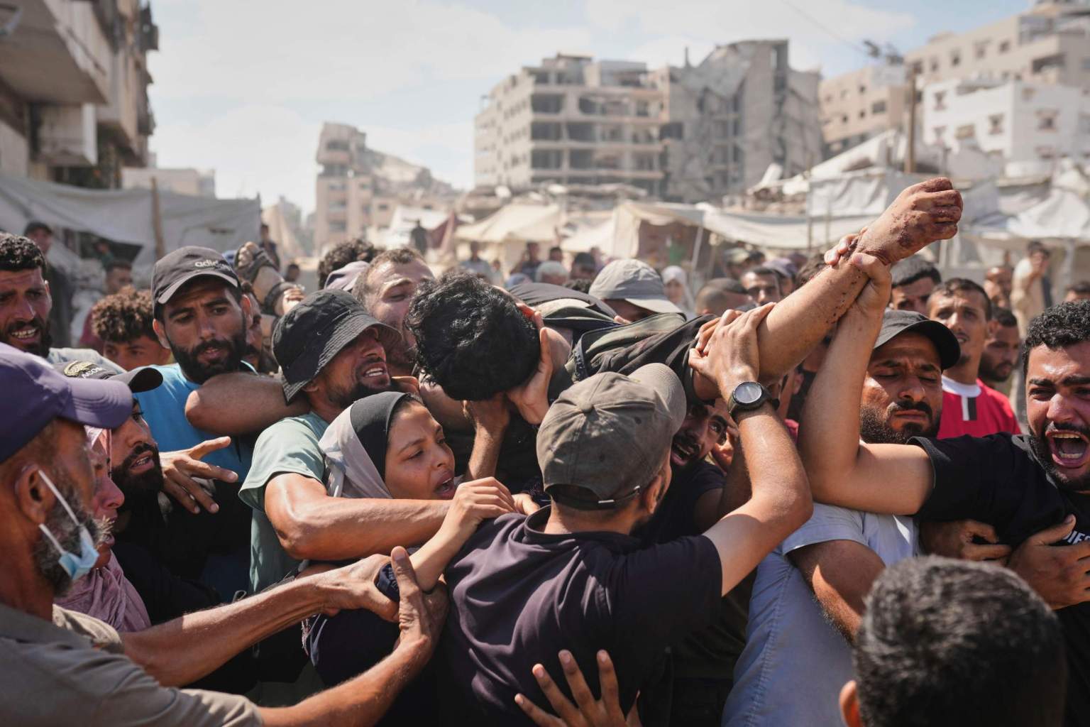 Famine on the Gaza Strip: ‘We See Children So Weak and Hungry They ...